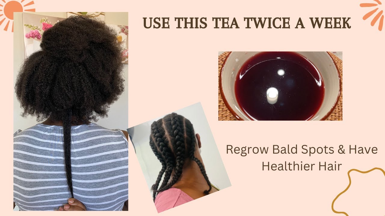 Just 3 ingredients | Regrow Bald Spots | Overnight Hair Growth Spray ...