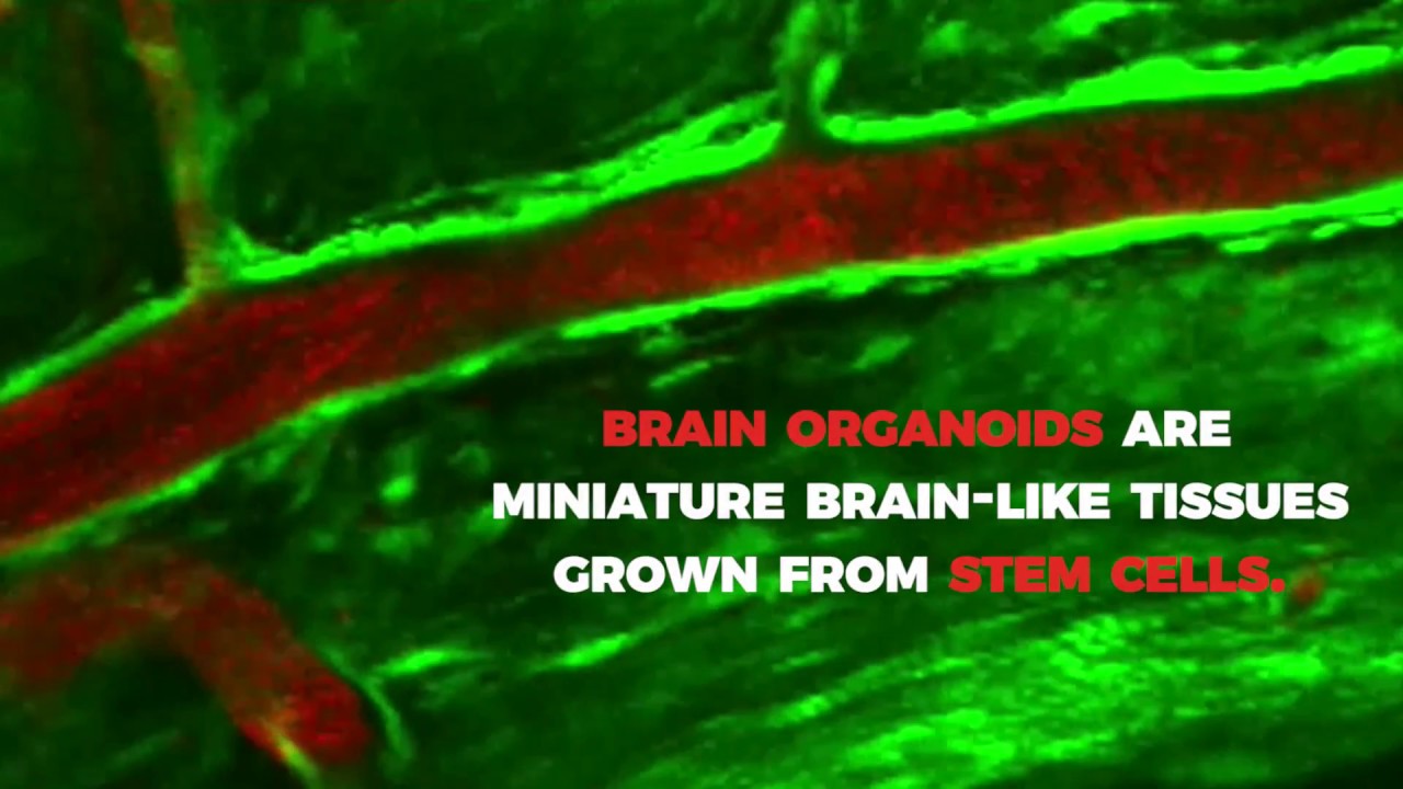 Brain Organoids As Models for Neurological Disorders - YouTube