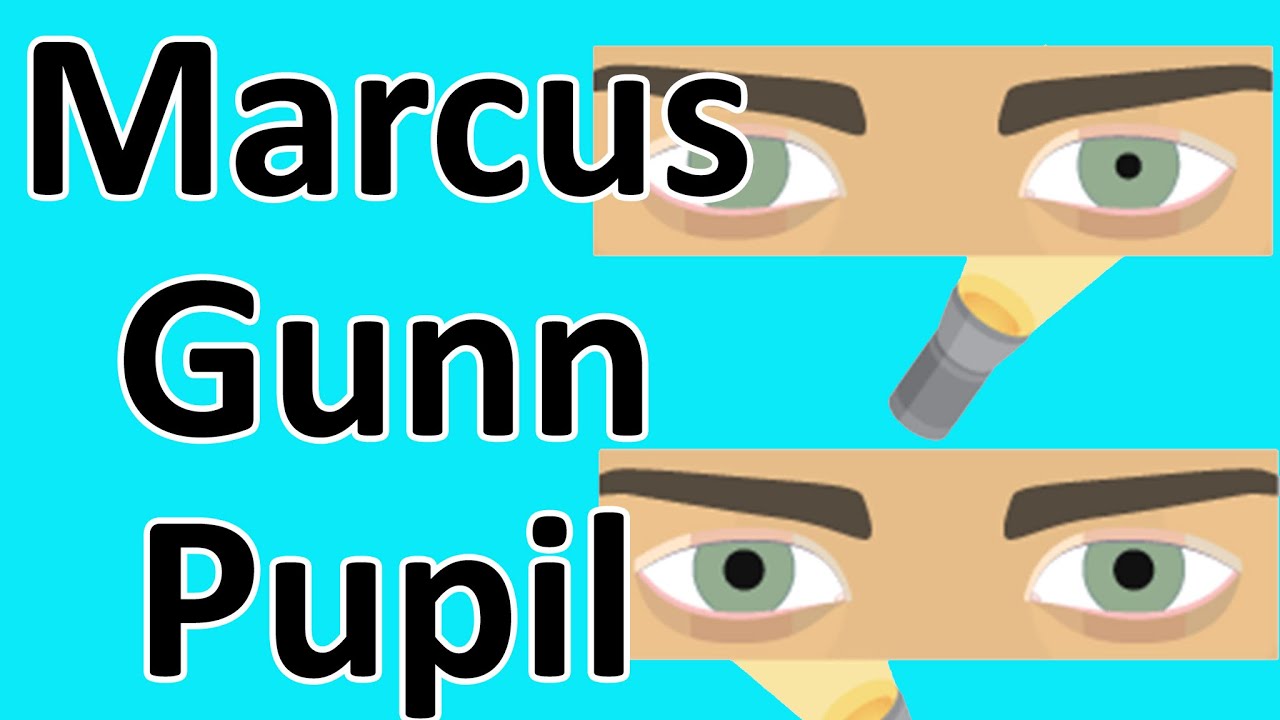 Marcus Gunn Pupil - YouTube