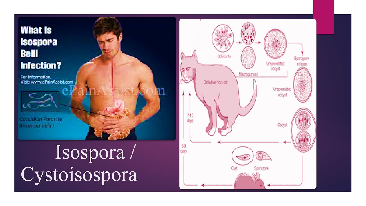 Isospora I Isoporiasis I Isospora belli life cycle I Cystoisosporiasis ...