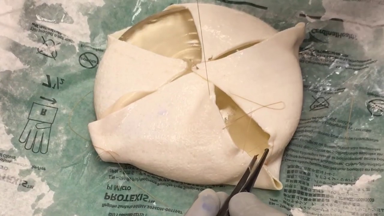 DTI ADM Wrap - Best Techniques for Surgery - YouTube