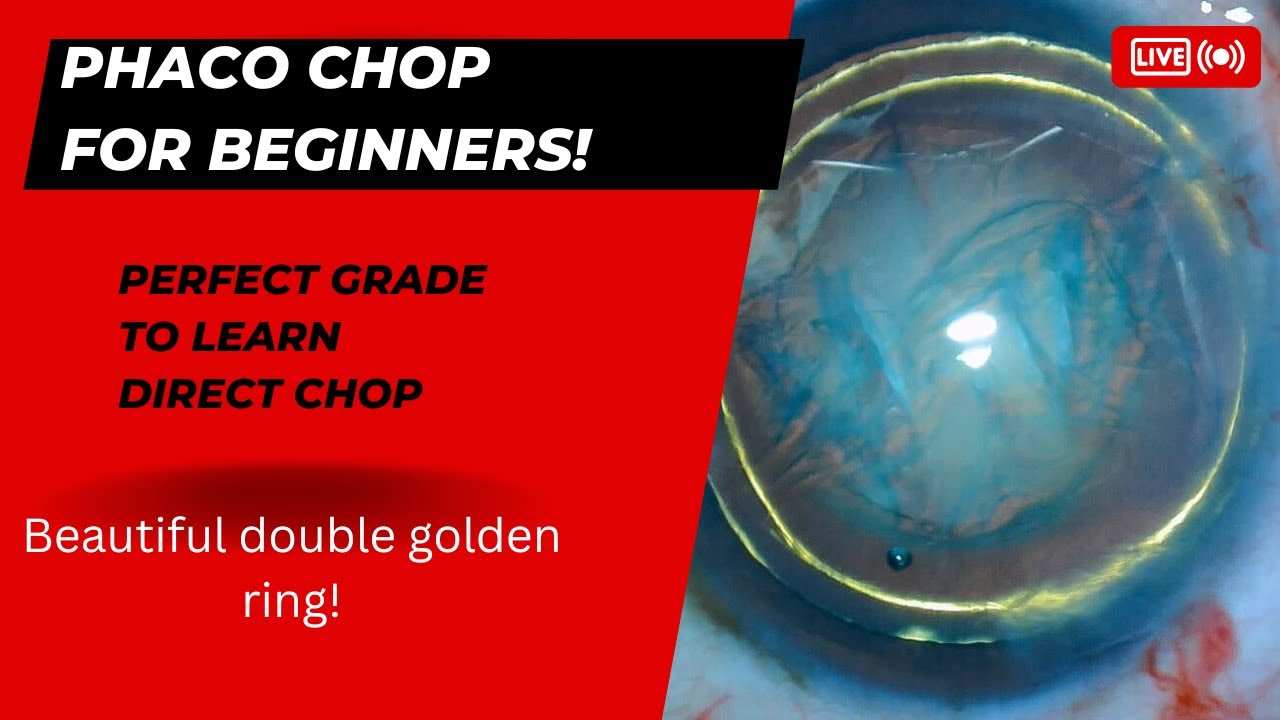 case series 35. Learn direct horizontal chop, for beginners, perfect ...