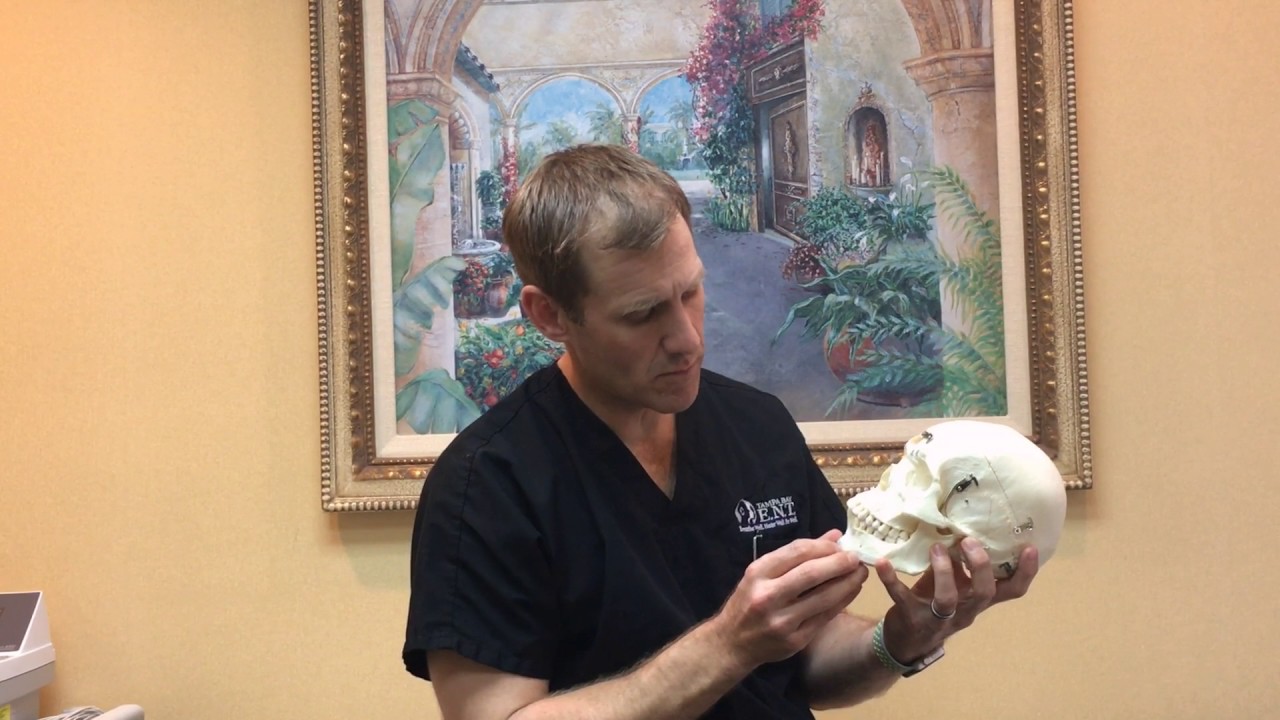 Chin and Cheek Implants by Tampa Plastic Surgeon, Dr. Dominic M ...
