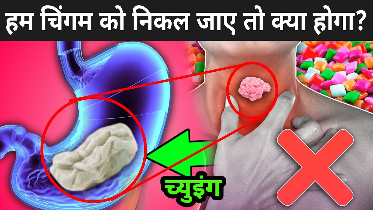 अगर आप च्युइंग गम निगल गए तो आपके साथ क्या होगा | What If You Swallow ...