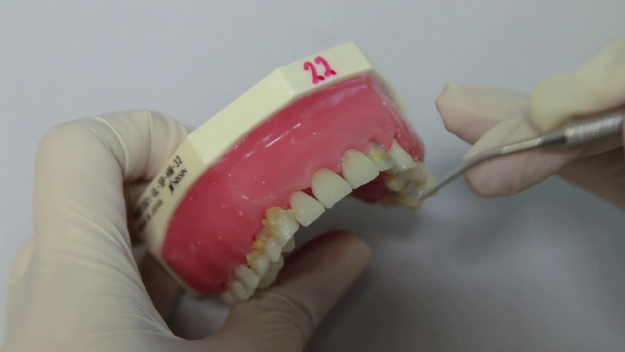 [Periodontal Examination Series] 7. Basic Periodontal Examination (BPE ...