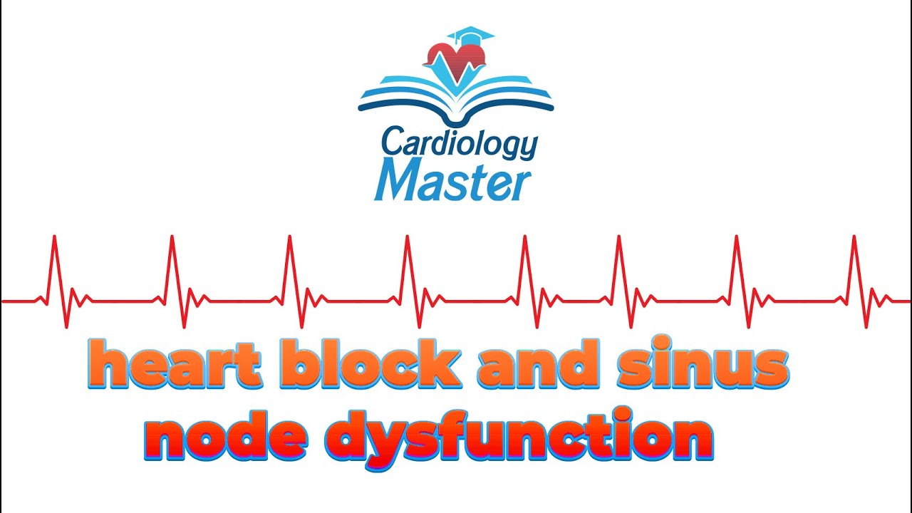 heart block and sinus node dysfunction - YouTube