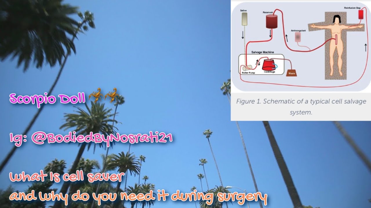 What is Cell Saver ? And why you need it during surgery!! Bbl tummy ...