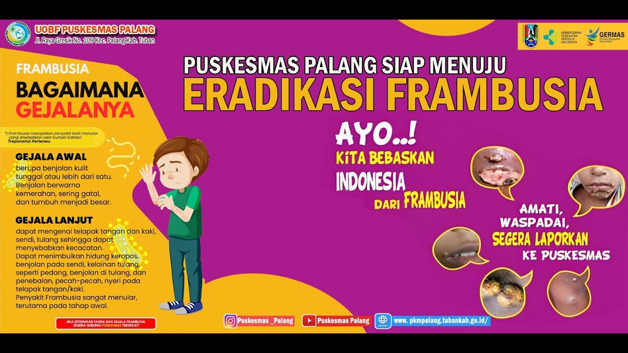 Eradikasi Frambusia - YouTube