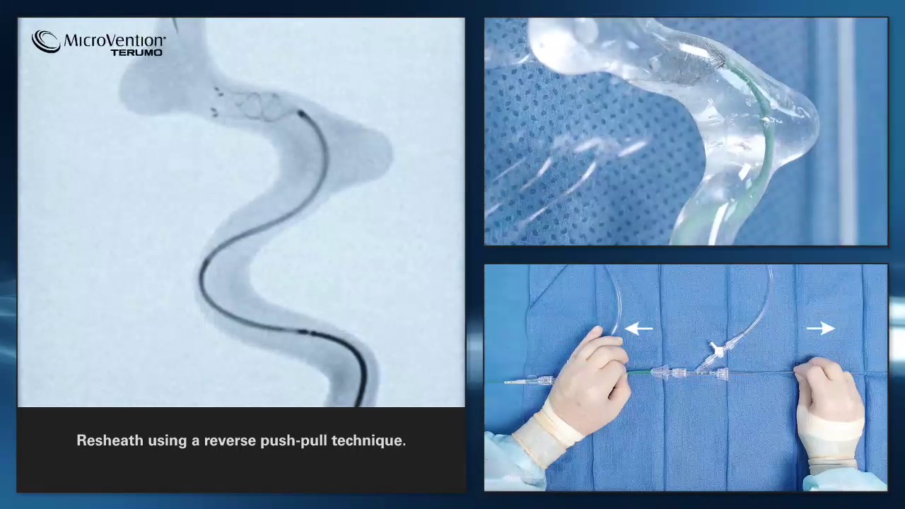 FRED Resheathing Process and Scenarios MV App - YouTube