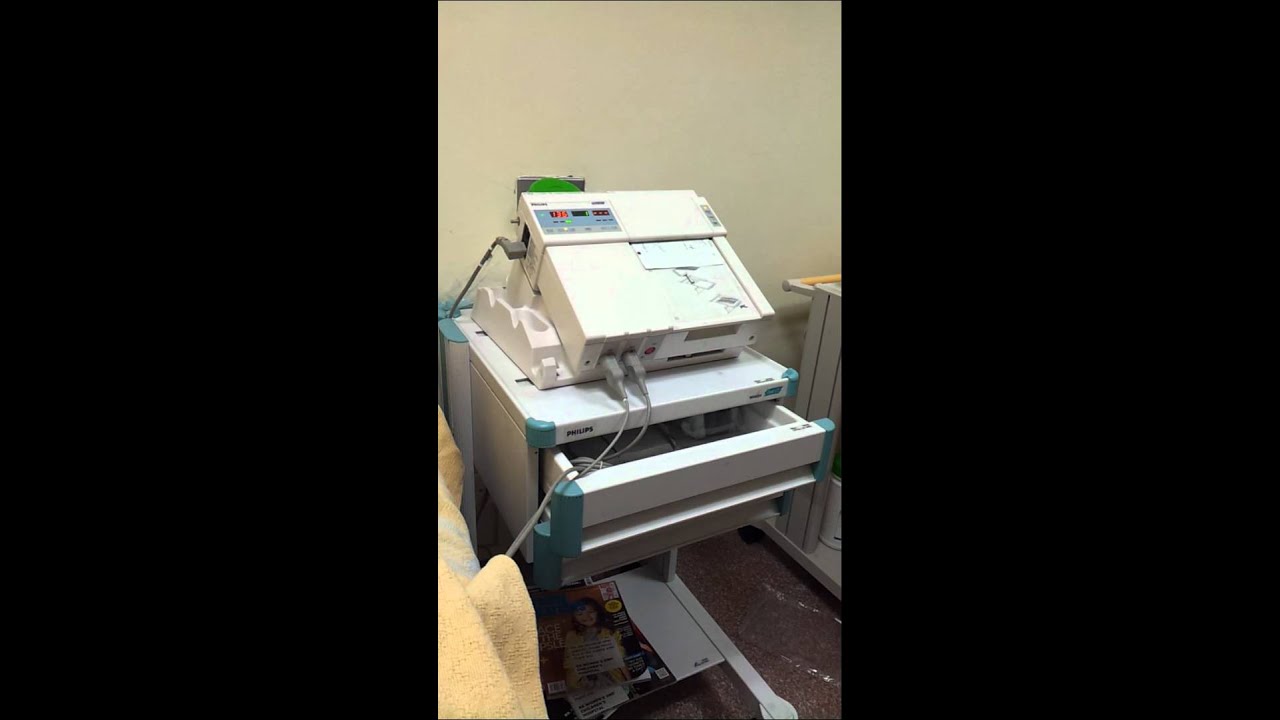Heartbeat trace. Ctg scan. - YouTube