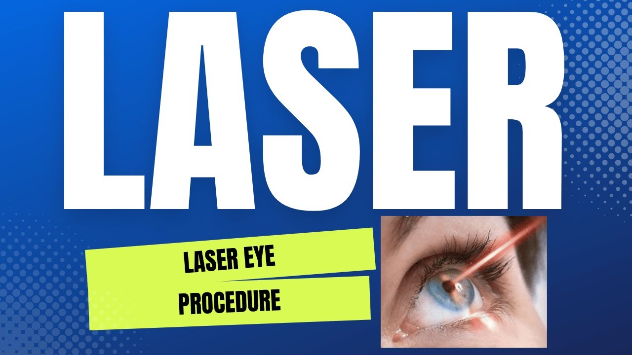 LASER SA MATA (LASER EYE PROCEDURE) - YouTube