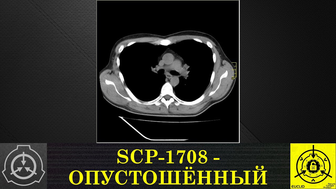 SCP-1708 - Опустошённый - YouTube
