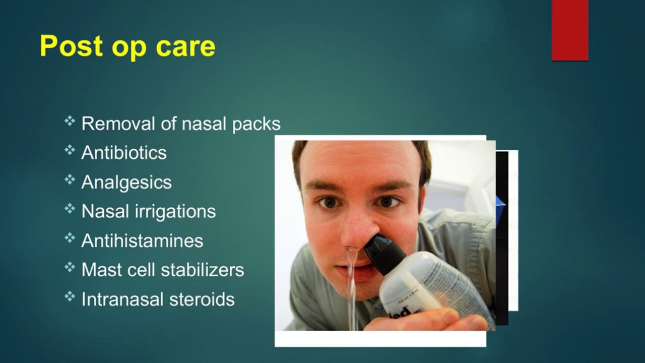 allergic rhinitis with nasal polyps - YouTube