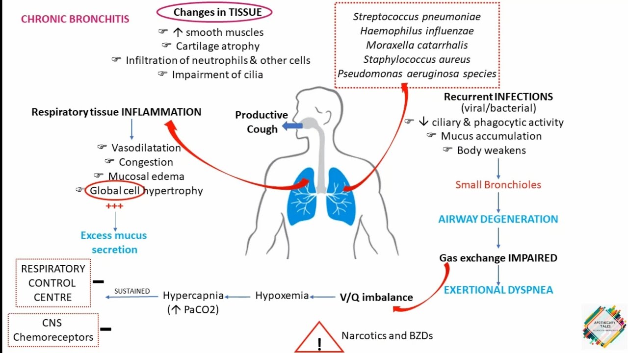 COPD : CHRONIC OBSTRUCTIVE PULMONARY DISEASE - INTRODUCTION - YouTube
