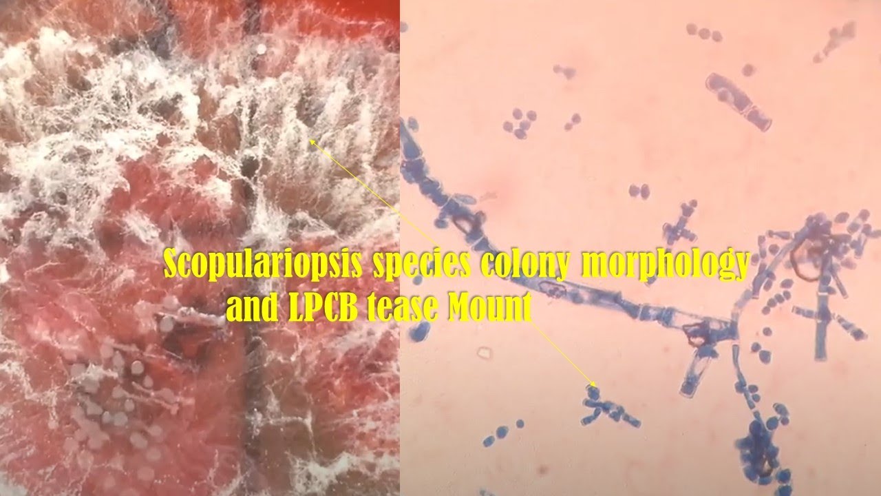 Scopulariopsis species colony morphology and LPCB tease Mount - YouTube
