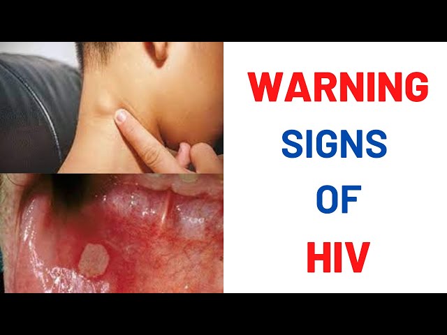 Hiv Aids Symptoms In Women