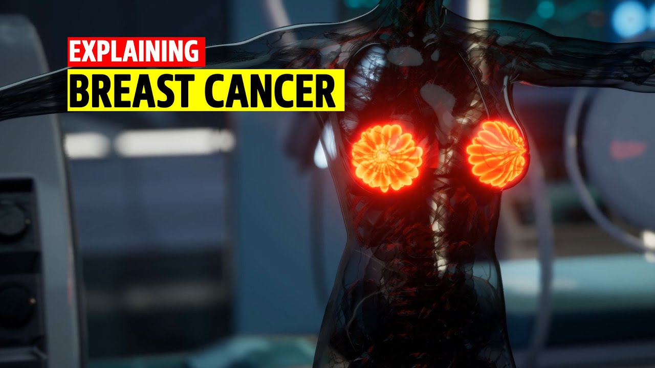 Explaining Breast Cancer - YouTube