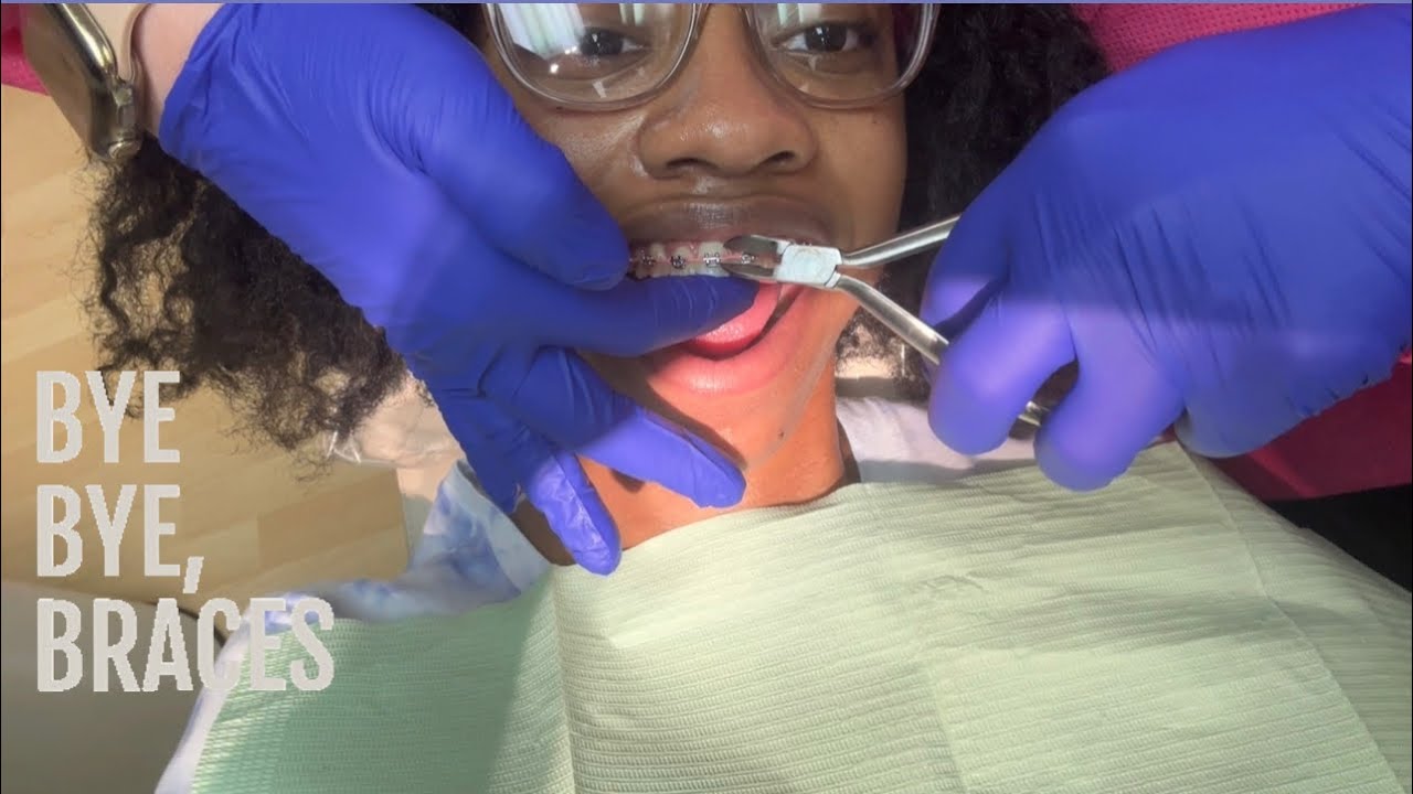 Getting My Braces Removed + Walmart Haul - YouTube