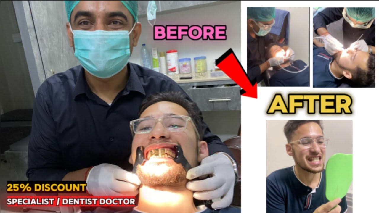 Finally Got The Teeth Cleaned 😬 | Dentist Vlog 😎 | ( New Vlog - 05 ...