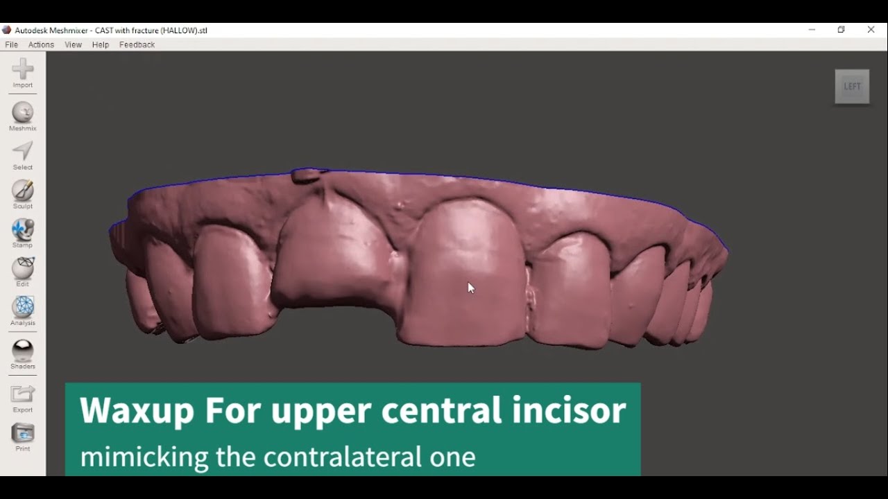 9- Simple method For Tooth waxup - Meshmixer For dental (Arabic) - YouTube