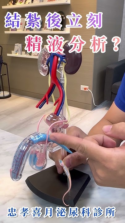 結紮後到底什麼時候才能驗精液?看影片了解😊忠孝喜月泌尿科診所 男性結紮 無痛結紮 精液分析 精子週期 泌尿道感染 性病 大安區 東區 性功能障礙 台北泌尿科 舒眠手術