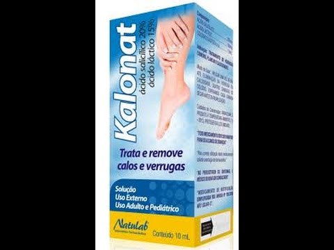 como remover verrugas rapidamente com remedio caseiro e acido kalonat ...