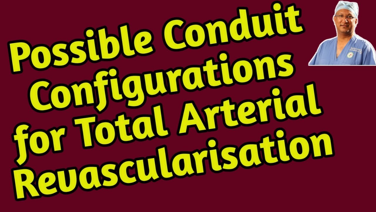 Various Possible Arterial Conduit Configurations For Total Arterial ...