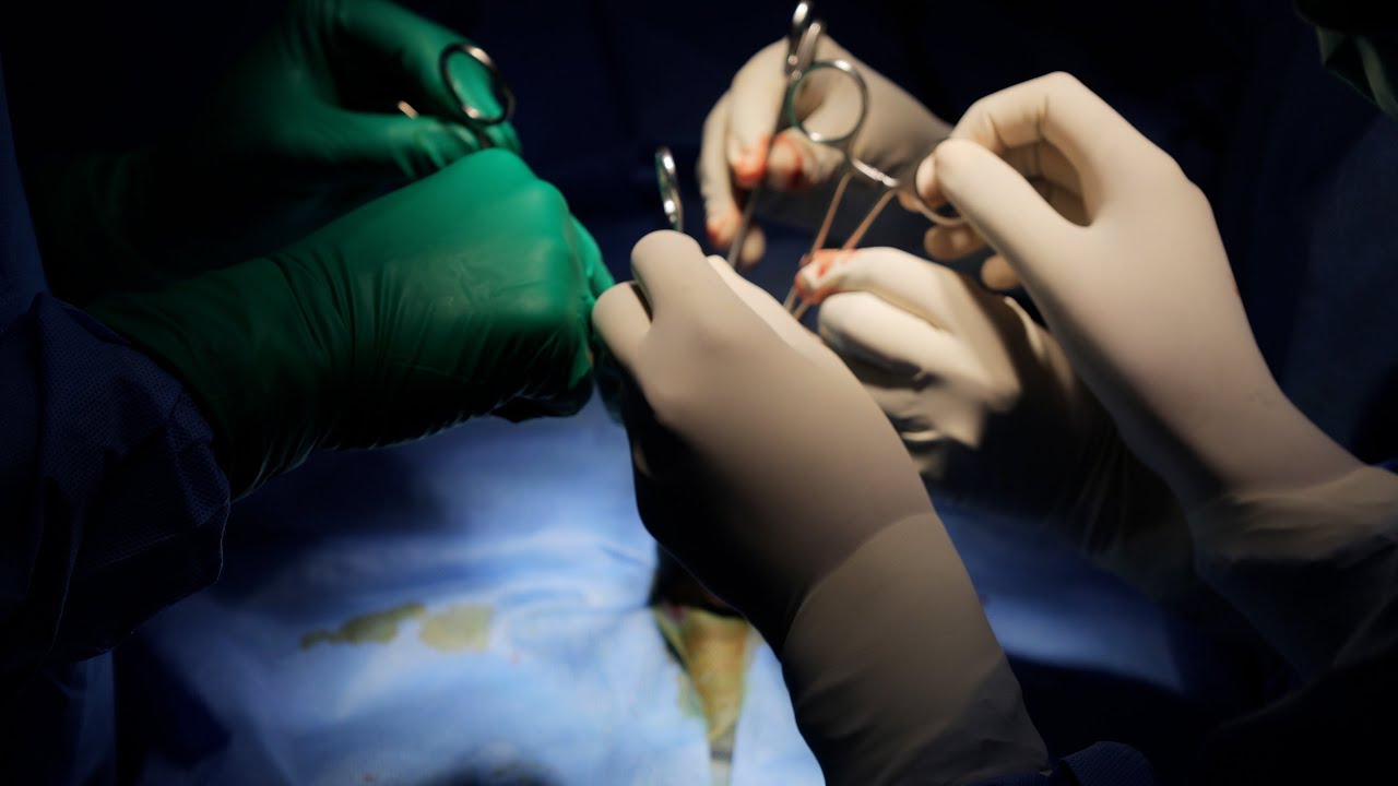 ZSR Stapler Circumcision with Frenuloplasty | Complete Surgical ...