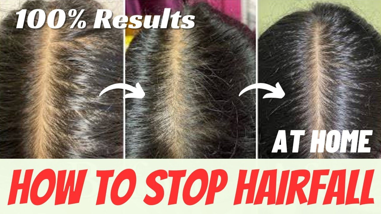 "Stop Hair Fall Naturally: DIY Remedy for Stronger, Healthier Hair!" 5 ...