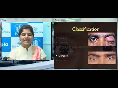 #Live_Webinar - Evaluation of Proptosis -Dr. Swathi Kaliki - YouTube