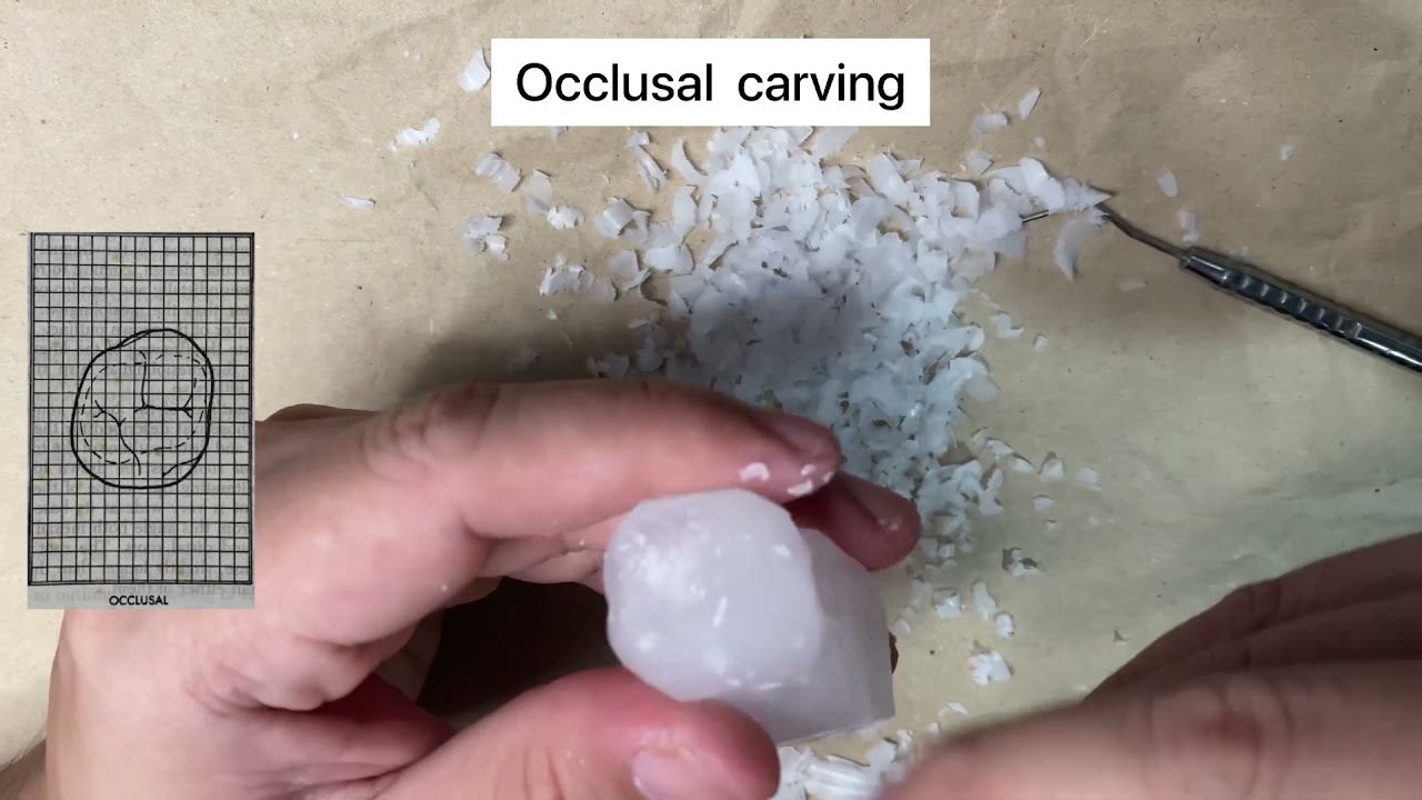 Carving of Maxillary Right First Molar - YouTube