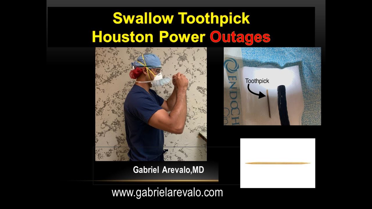 Endoscopic foreign body removal. Toothpick. Houston - YouTube