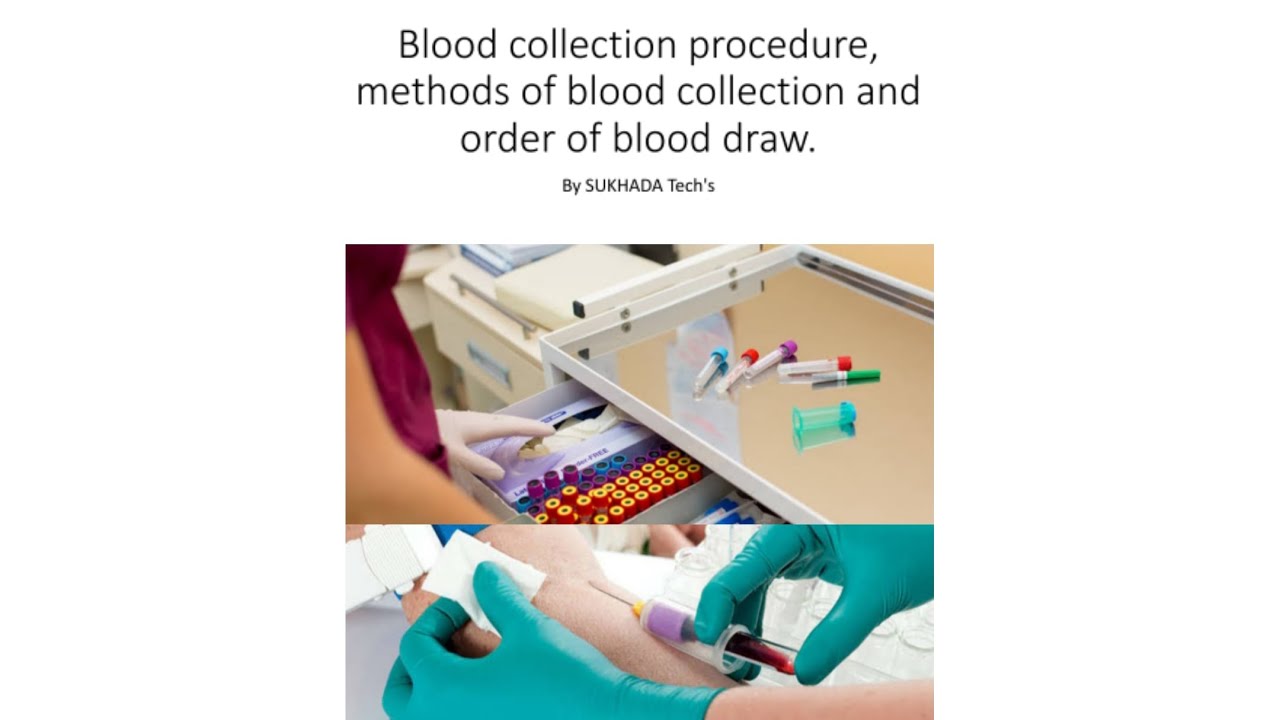 Phlebotomy - collection procedure, methods of collection and order of ...