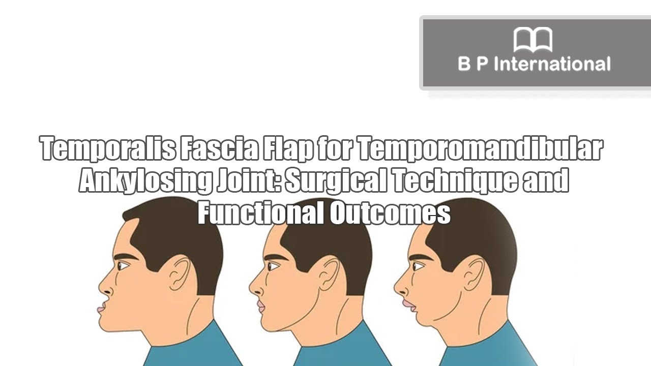 Temporalis Fascia Flap for Temporomandibular Ankylosing Joint: Surgical Technique - YouTube