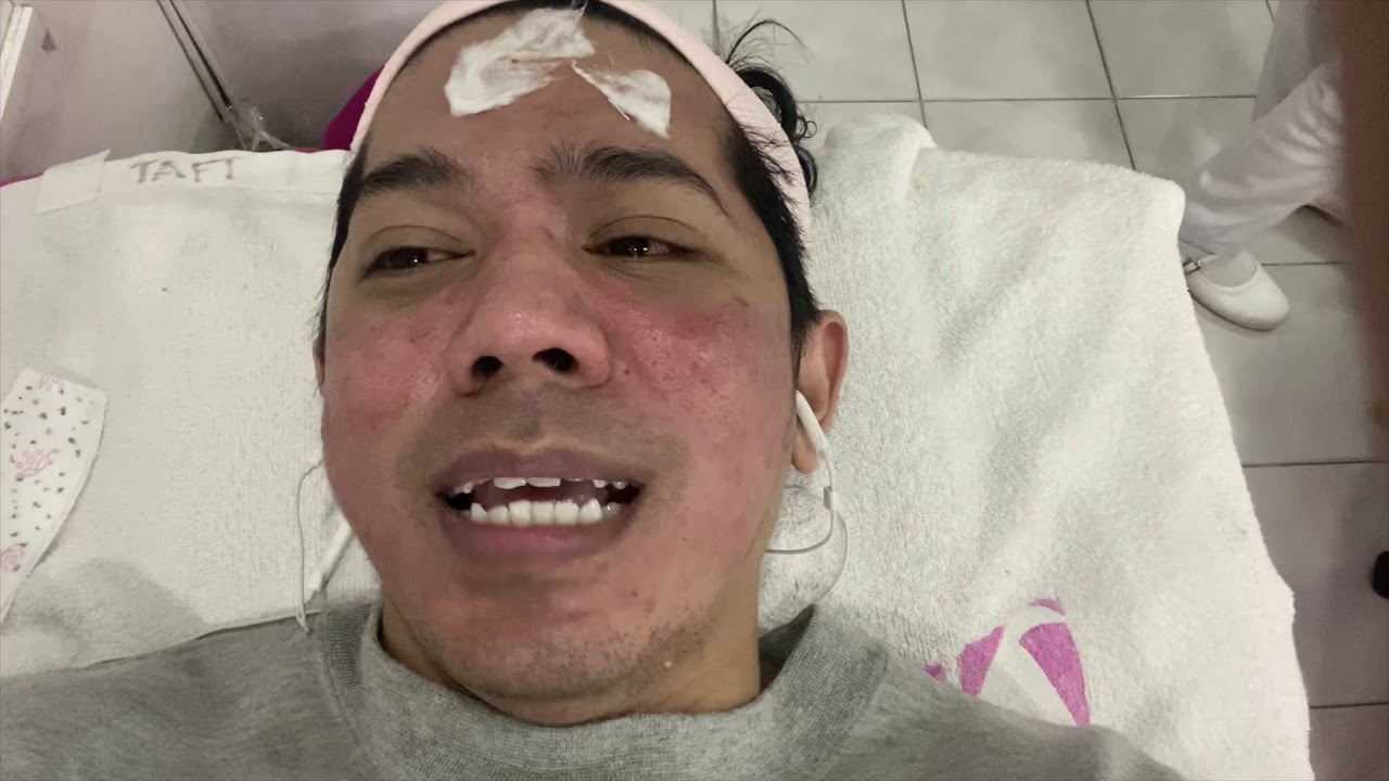 #Metrodeal #Dermcare #FacialTreatment Metrodeal Vouchers, Ayos nga ba ...
