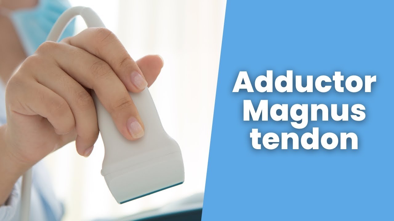 Adductor Magnus tendon and insertion in relation to proximal hamstring ...