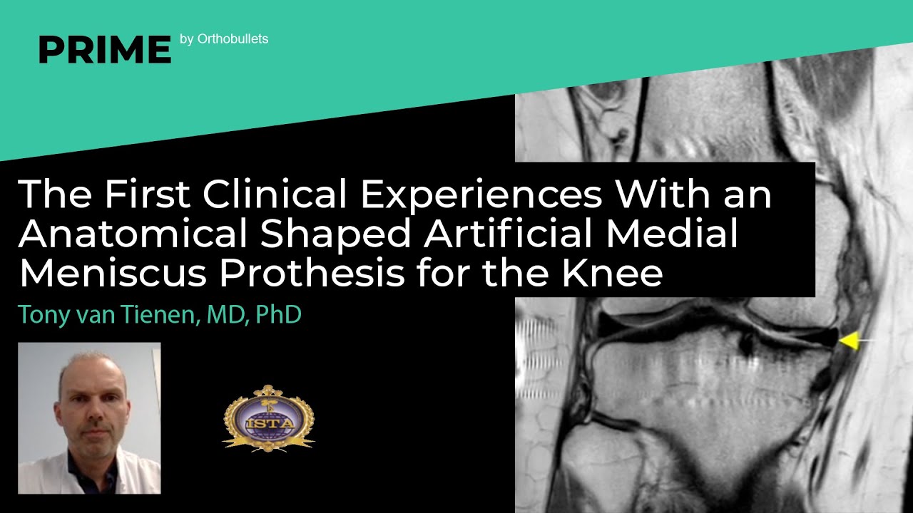 Anatomical Shaped Artificial Medial Meniscus Prothesis for the Knee ...