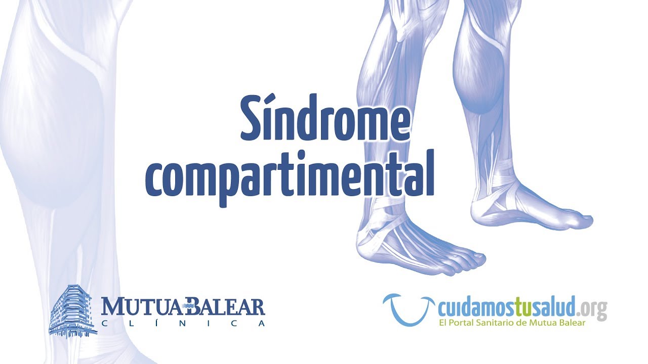 PROTOCOLO DE DETECCIÓN PRECOZ DEL SÍNDROME COMPARTIMENTAL - YouTube