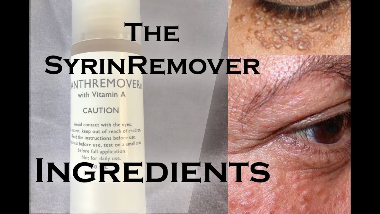 THE SYRINREMOVER INGREDIENTS TO REMOVE YOUR SYRINGOMA AT HOME - YouTube