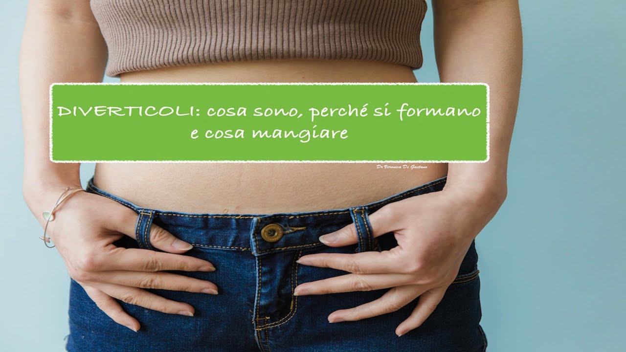 Diverticoli: cosa sono, perché si formano e cosa mangiare - YouTube