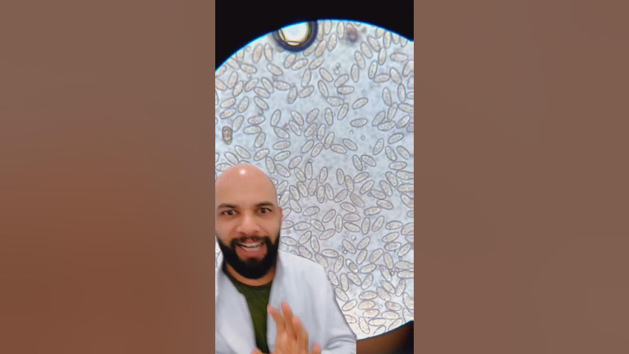 🧐 Ovo de Enterobius vermicularis nas fezes? Fique atento! - YouTube