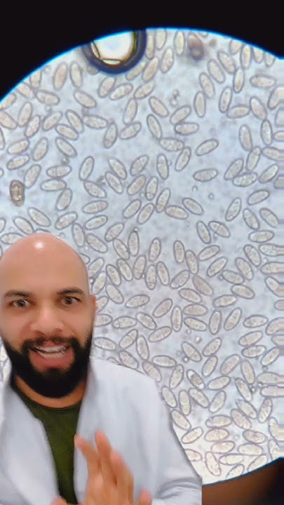 🧐 Ovo de Enterobius vermicularis nas fezes? Fique atento! - YouTube