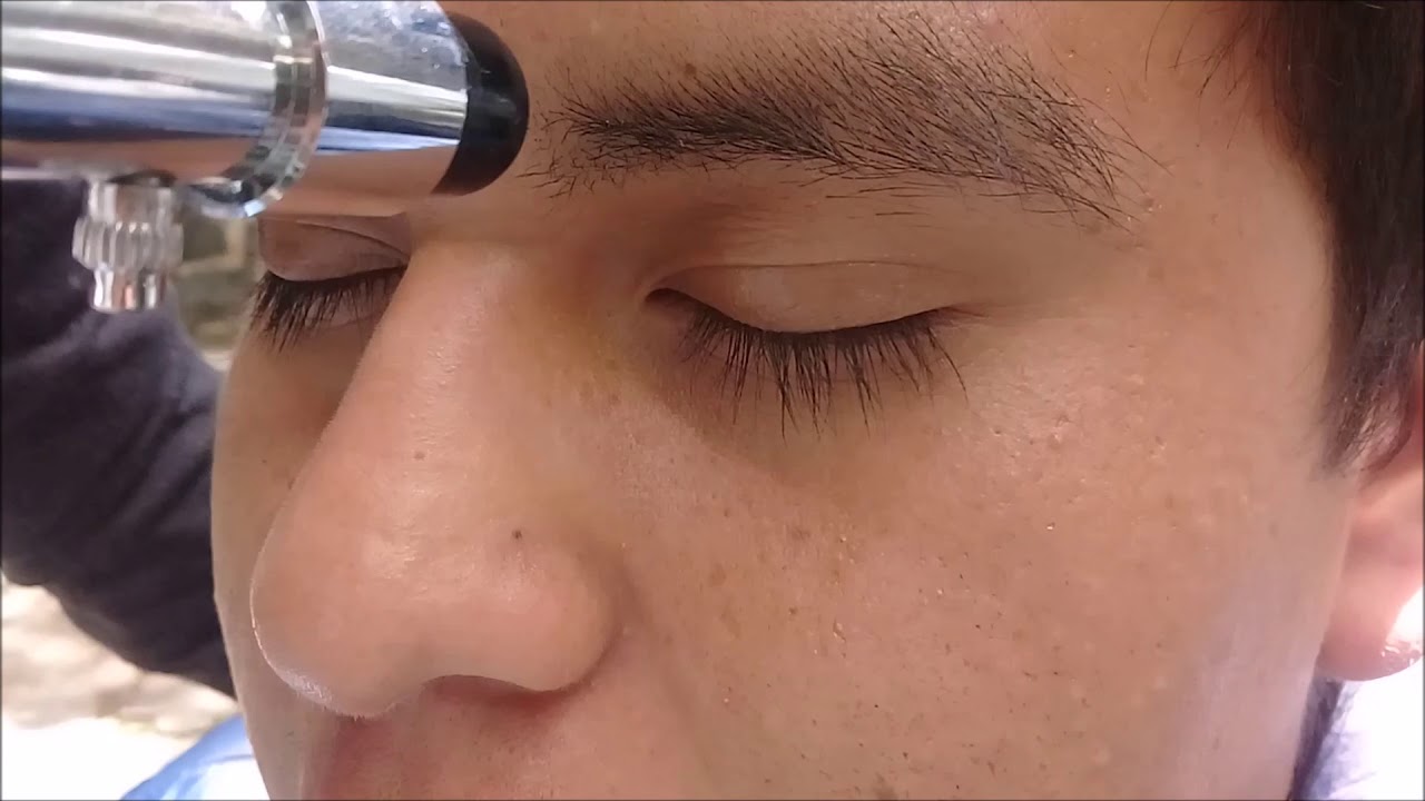 REFLEJO SUPERCILIAR - YouTube