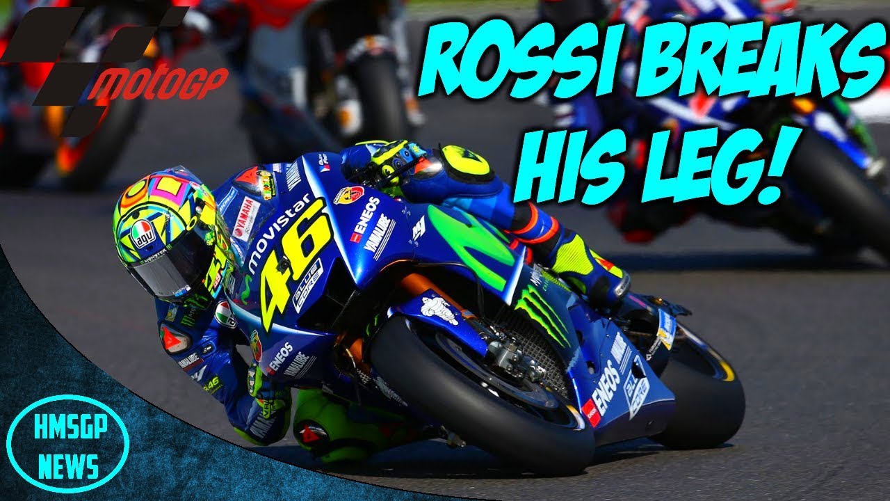 MotoGP News: Valentino Rossi Breaks His Leg In Training! - YouTube