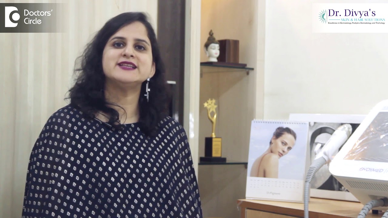 How to get rid of dandruff dr Divya Sharma - YouTube