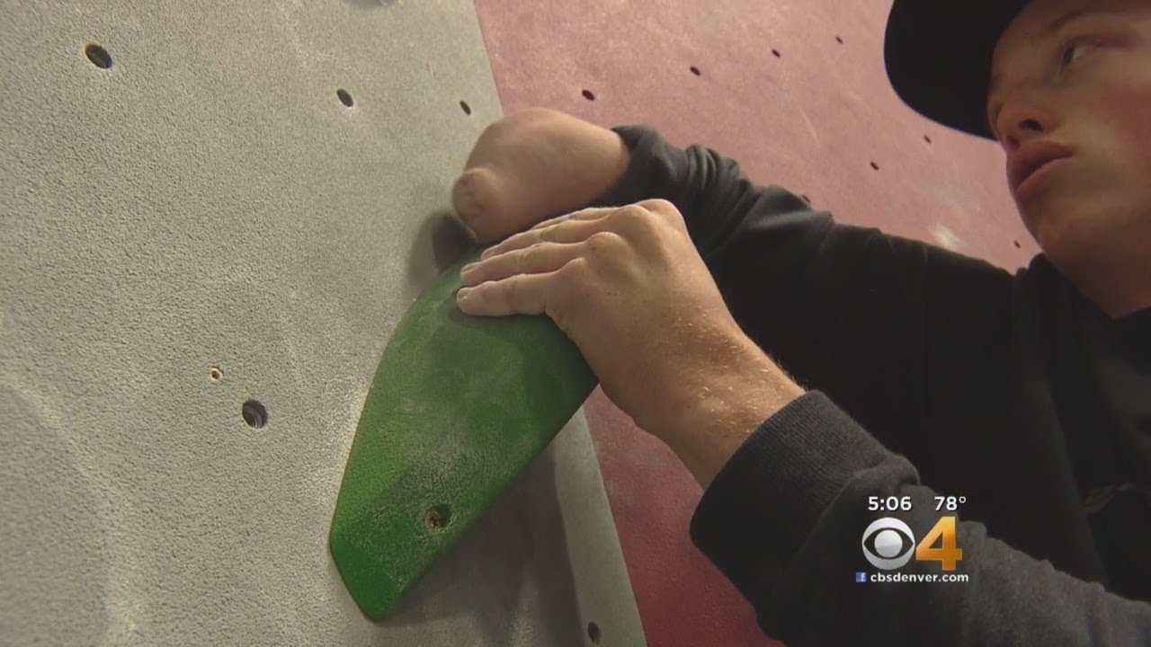 Teenage Climber With One Hand Is 'Unlimbited' - YouTube