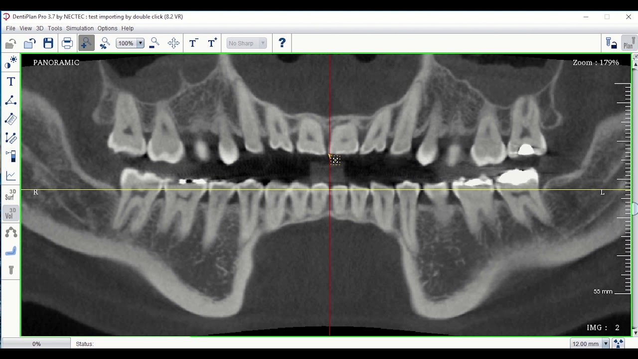 5 การสร้างมุมมอง Panoramic View and Cross- Sectional View - YouTube