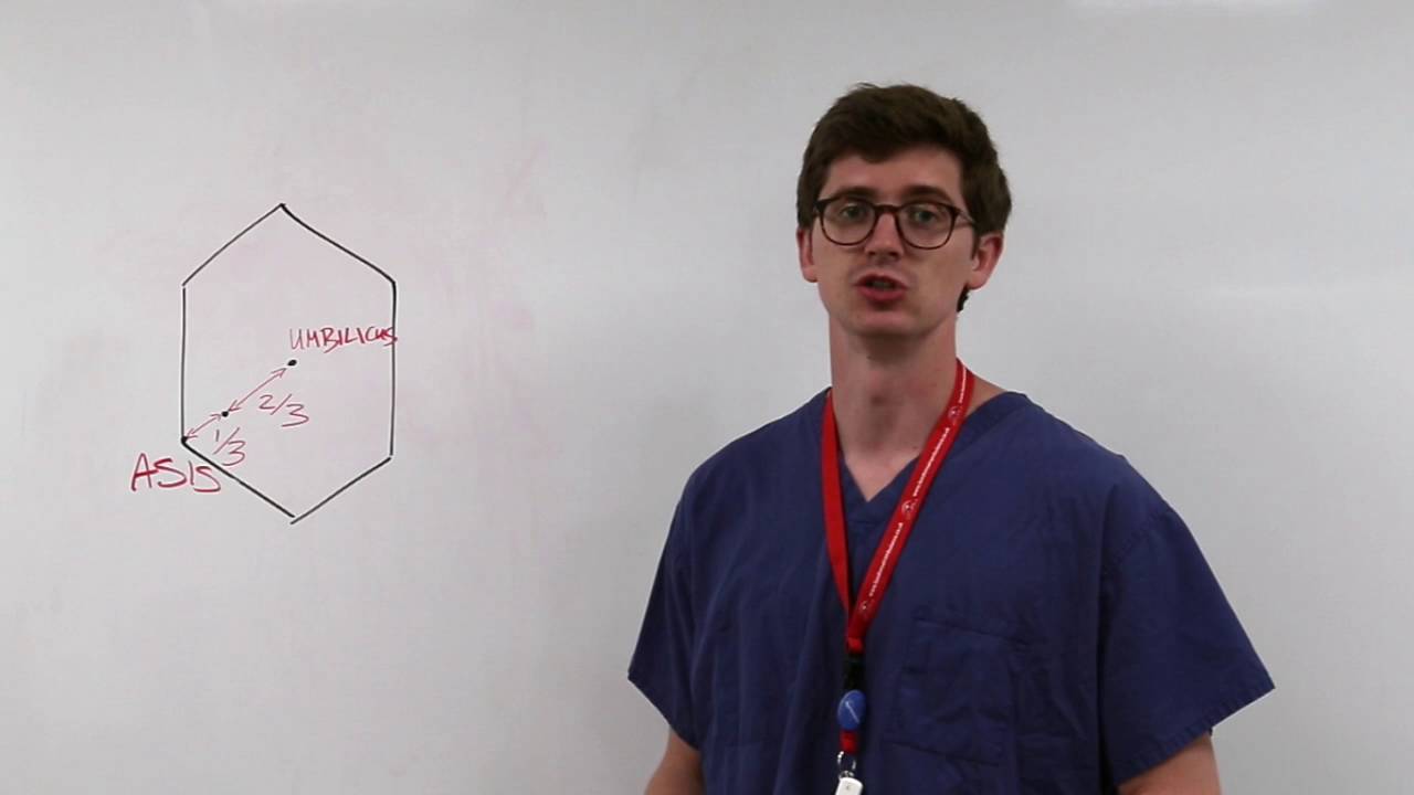 McBurney's Sign - YouTube