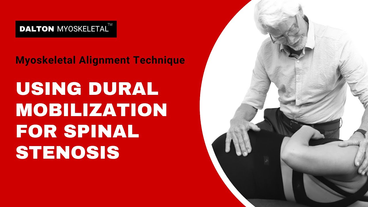 Using Dural Mobilization for Spinal Stenosis | ErikDalton.com - YouTube