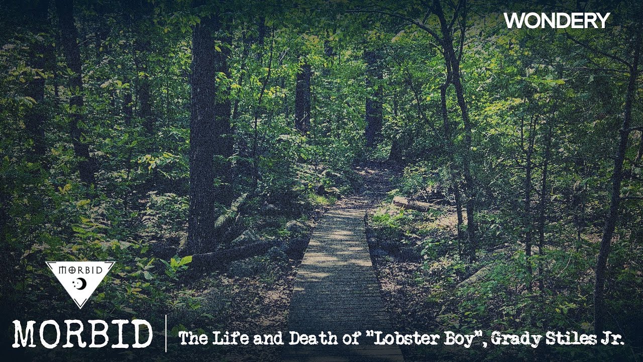 The Life and Death of “Lobster Boy”, Grady Stiles Jr. | Morbid ...